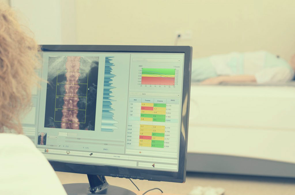 Bone Density - Brighton, CO -Spectrum Medical Imaging